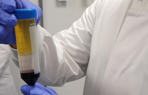 Researching to beat antimicrobial resistance: A day in the life of a CF ...